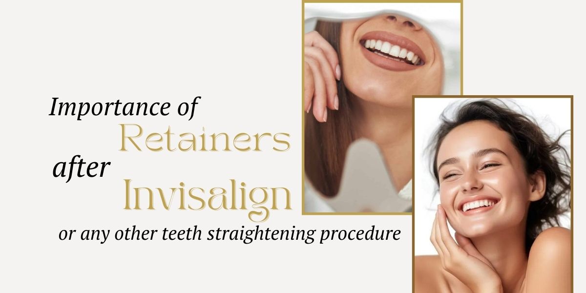 retainers after Invisalign or any other teeth straightening procedure